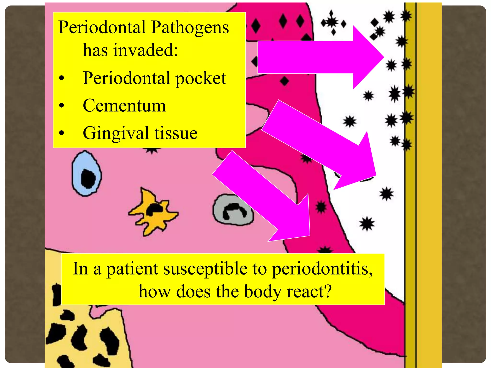 Pathogenesis of periodontitis | PPTX