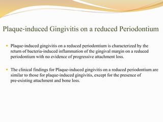 Pathogenesis of plaque associated periodontal disease | PPTX