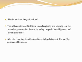Pathogenesis of plaque associated periodontal disease | PPTX