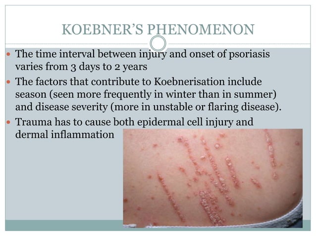 PATHOGENESIS OF PSORIASIS.pptx | Skin and Dermatology | Diseases and ...