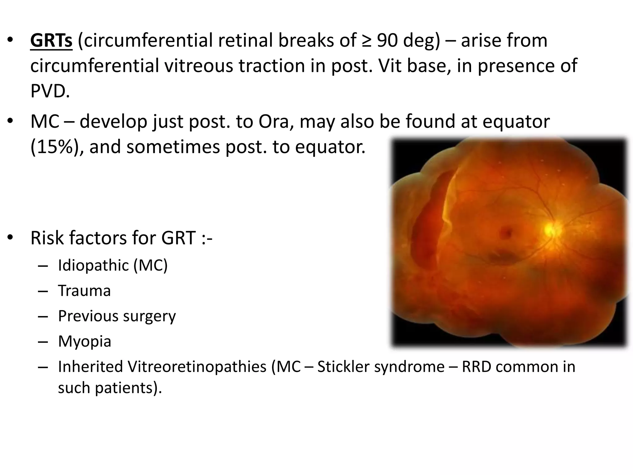 Pathogenetic mechanism of Retinal Detachment | PPTX