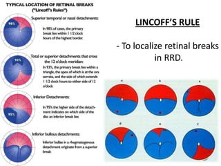Pathogenetic mechanism of Retinal Detachment | PPTX