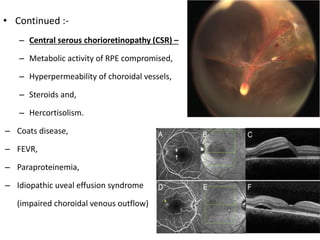 Pathogenetic mechanism of Retinal Detachment | PPTX