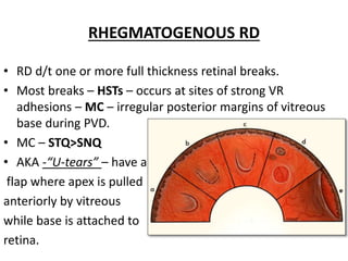 Pathogenetic mechanism of Retinal Detachment | PPTX