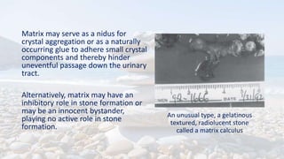 Pathogenesis of Urolithiasis | PPT