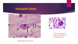 pathogenesis of viruses and host defense sk (1).pptx