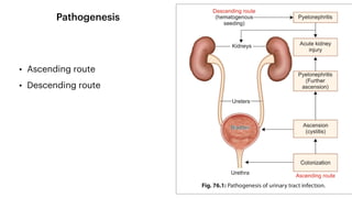 Pathogenesis uti (urinary tract infection) .pdf