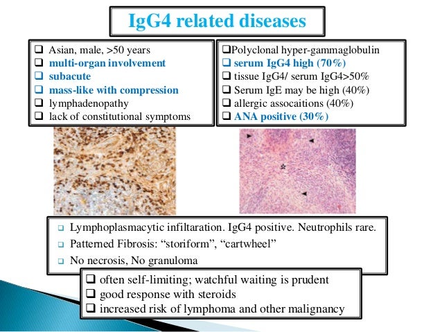 Pathogenetic issues of IgG4 related diseases