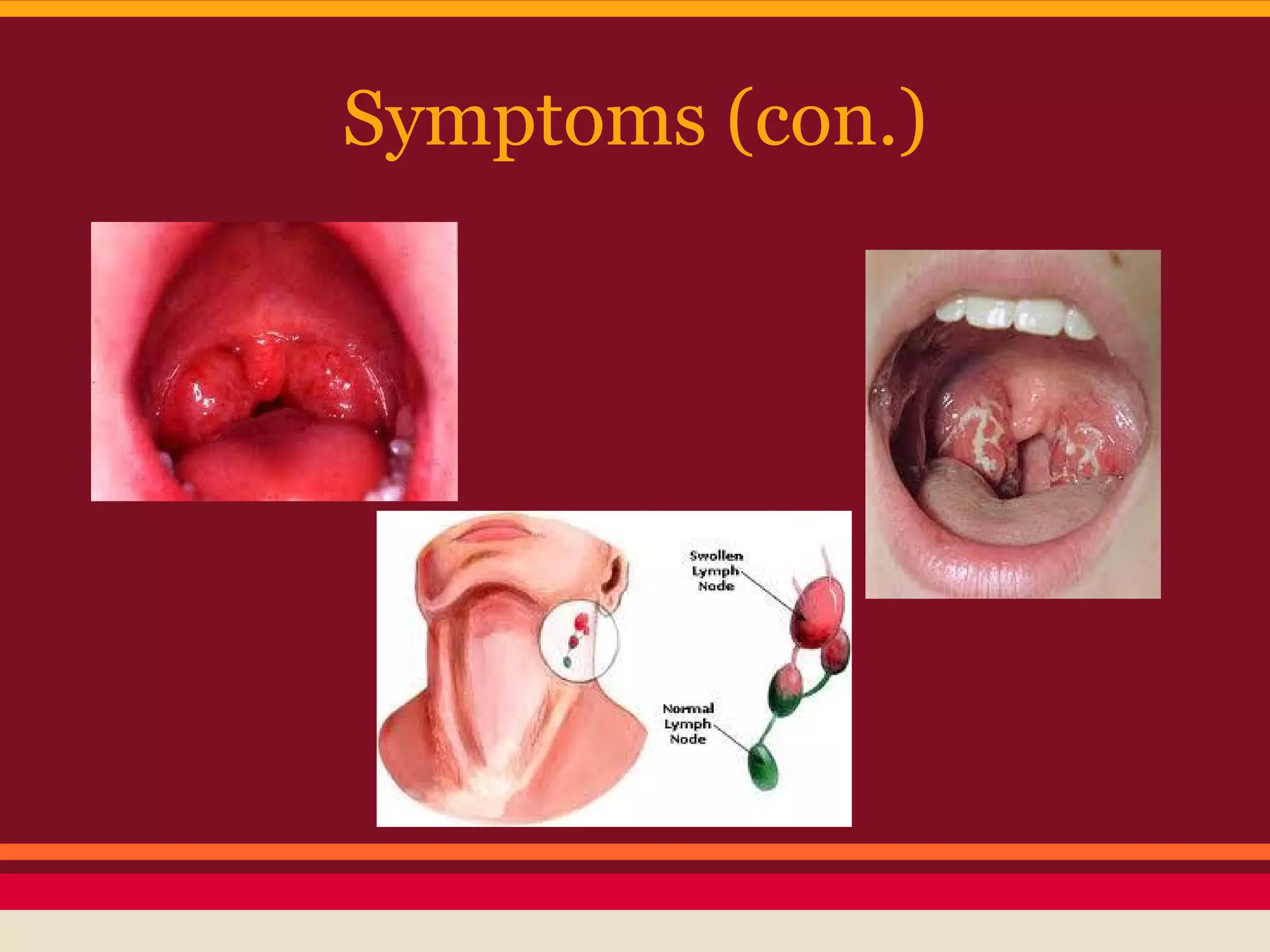 Pathogen project | PPT
