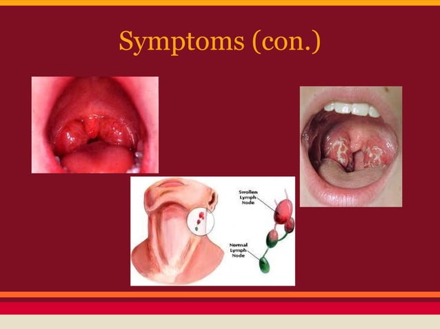 Pathogen project | PPT