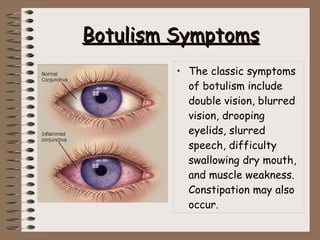 Pathogens And Toxins | PPT
