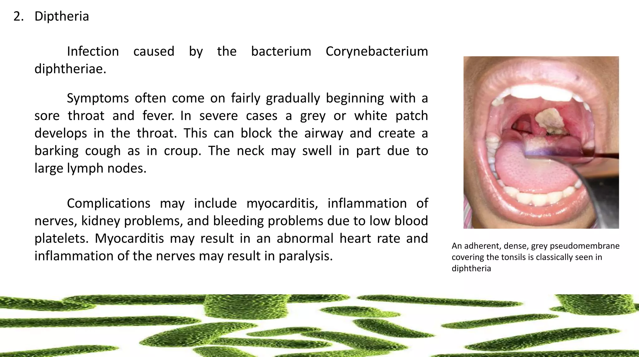 Pathogens in milk | PPTX