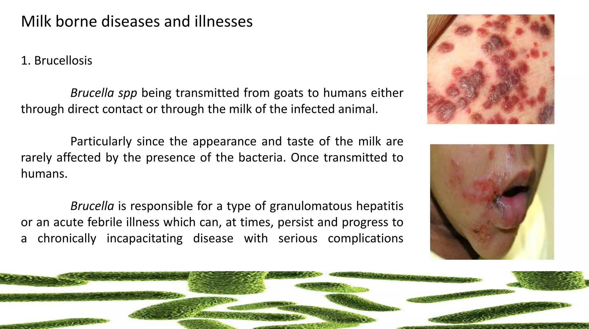 Pathogens in milk | PPTX