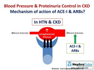 CKD (Pathogensis and Progression) - Dr. Gawad | PPT