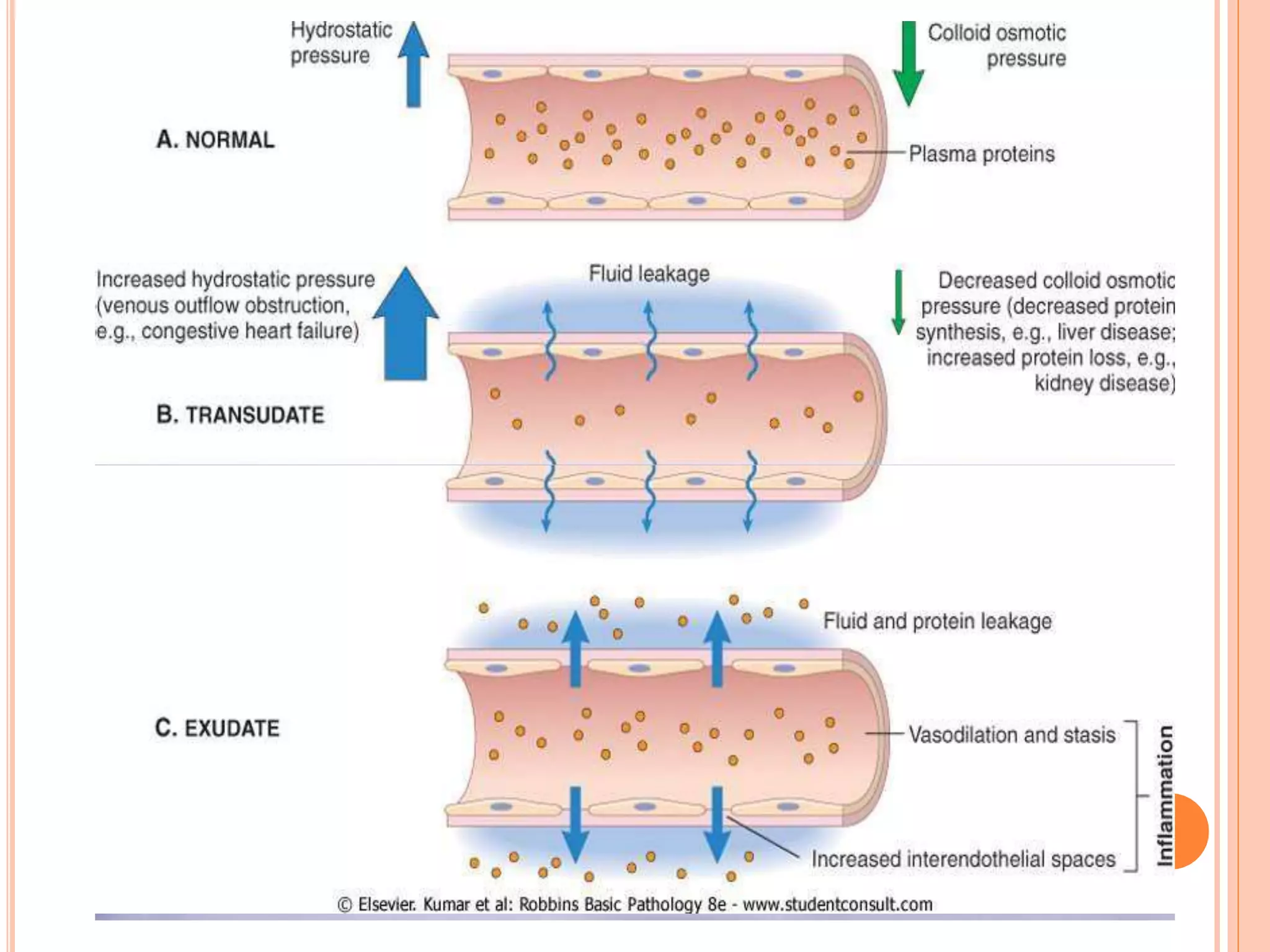 Patho inflammation | PPTX