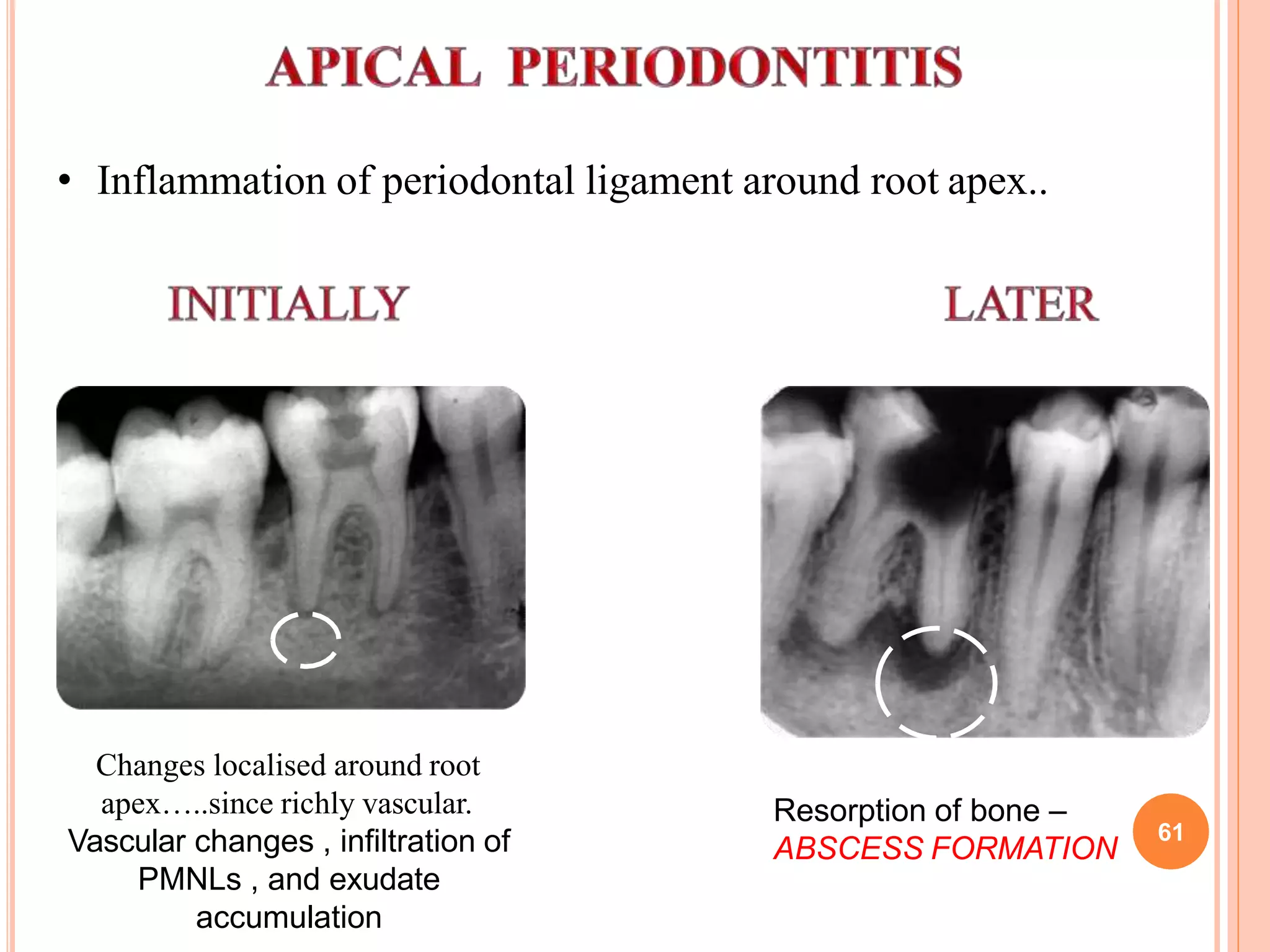 Patho inflammation | PPTX