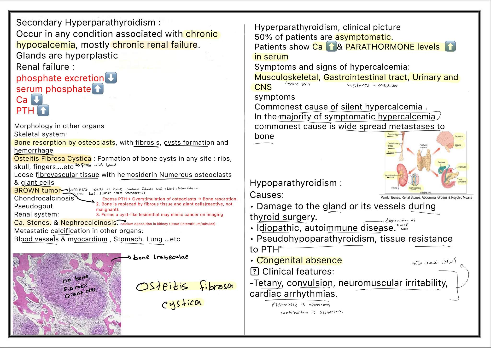 Parathyroid gland pathology for second year | PDF