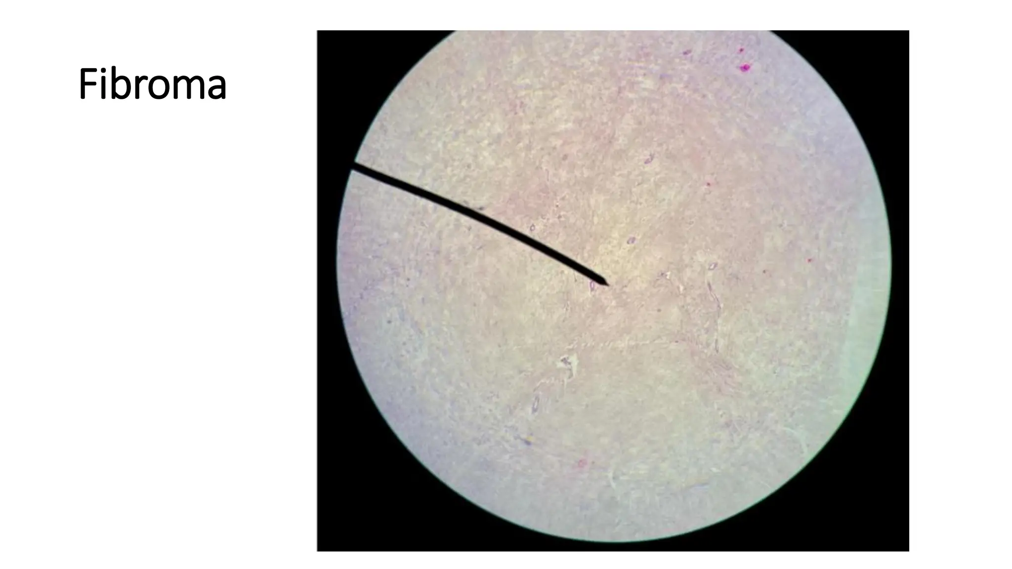 Patho lab pics.pdf patho love pics pathology | PDF | Medical Health