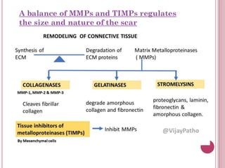 Patho, Lecture “10”,Tissue repair Pathology 2.pdf
