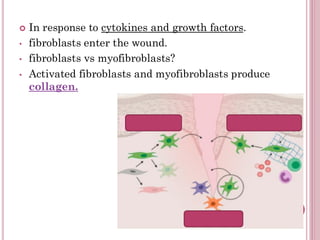 Patho, Lecture “10”,Tissue repair Pathology 2.pdf