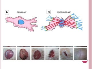Patho, Lecture “10”,Tissue repair Pathology 2.pdf