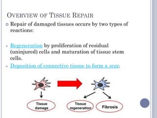 Patho, Lecture “9”,TISSUE REPAIR Pathology.pdf