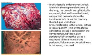Pathological anatomy of chronic bronchitis, bronchiectasis..pptx
