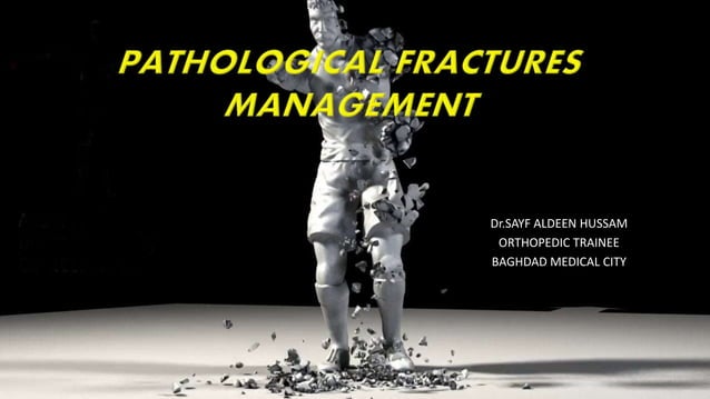 Pathological fractures managment | PPTX