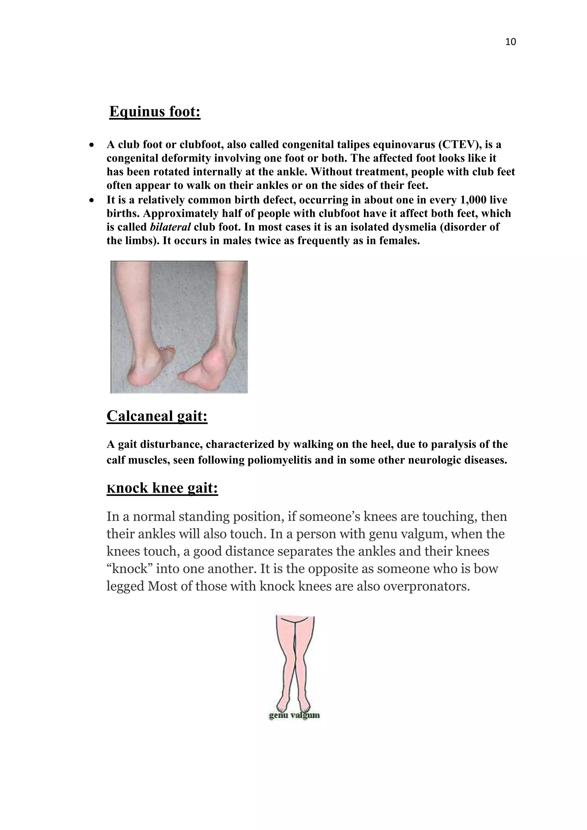 Pathological gait | DOCX