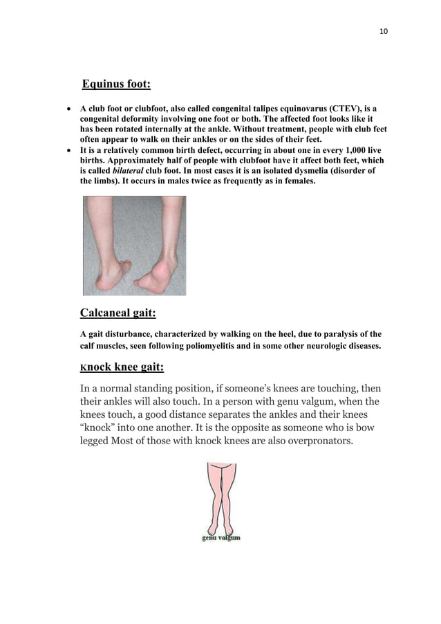 Pathological gait | DOCX | Death, Injury, or Military Conflict ...