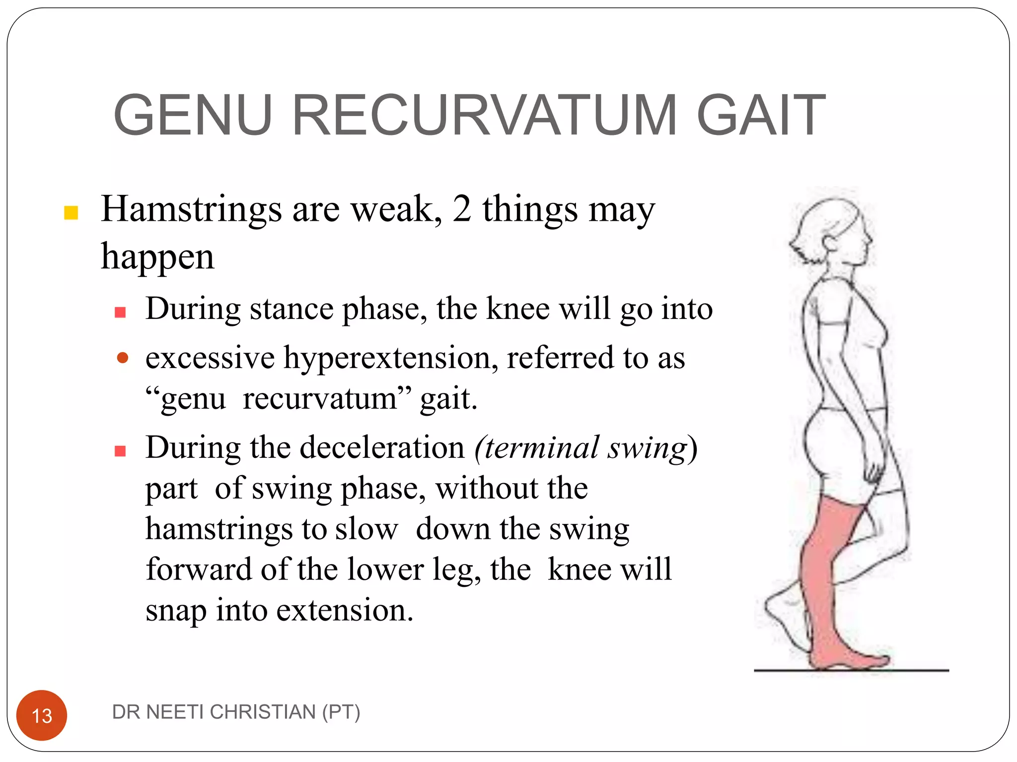 Pathological gait | PPTX