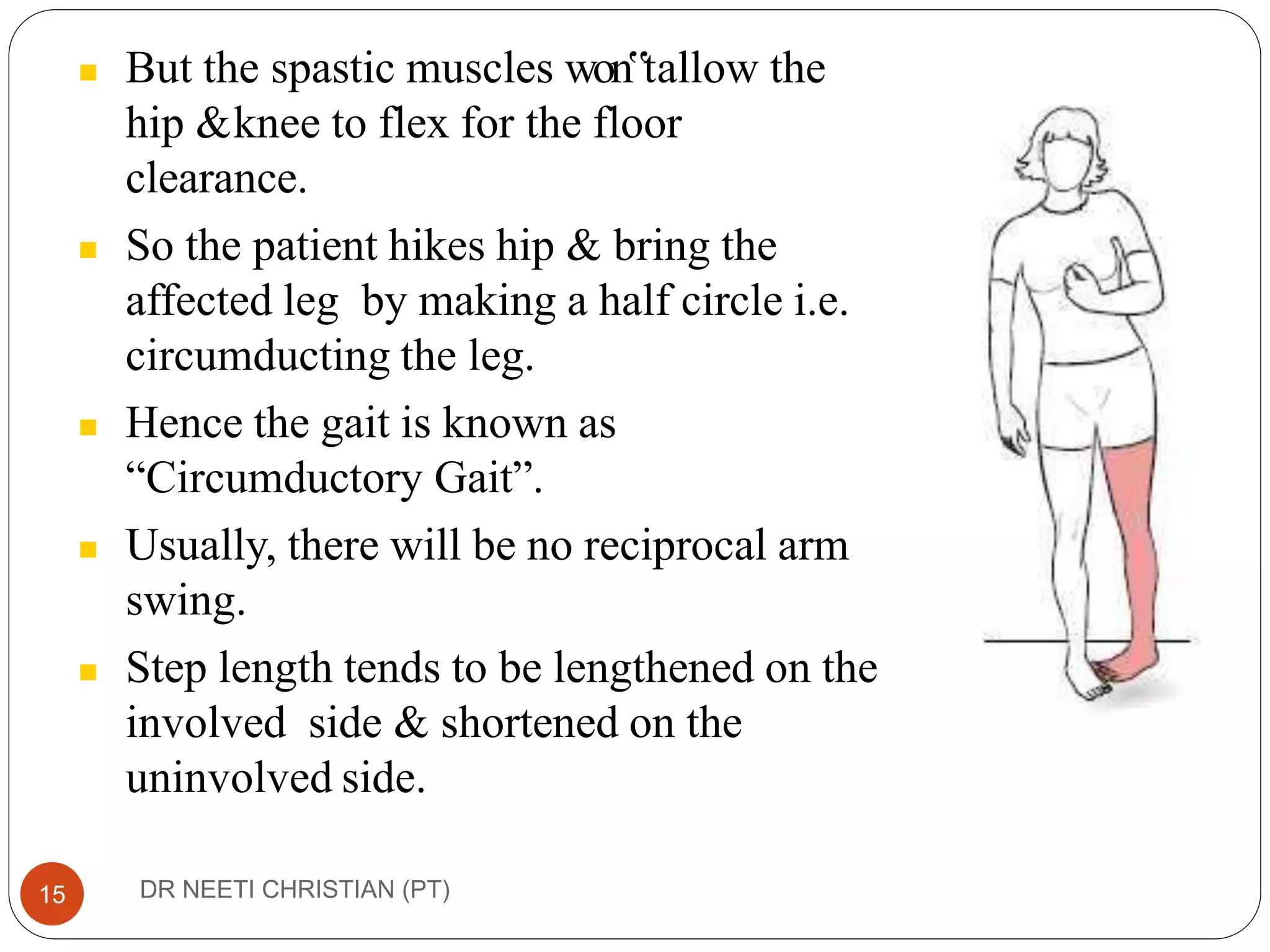 Pathological gait | PPTX