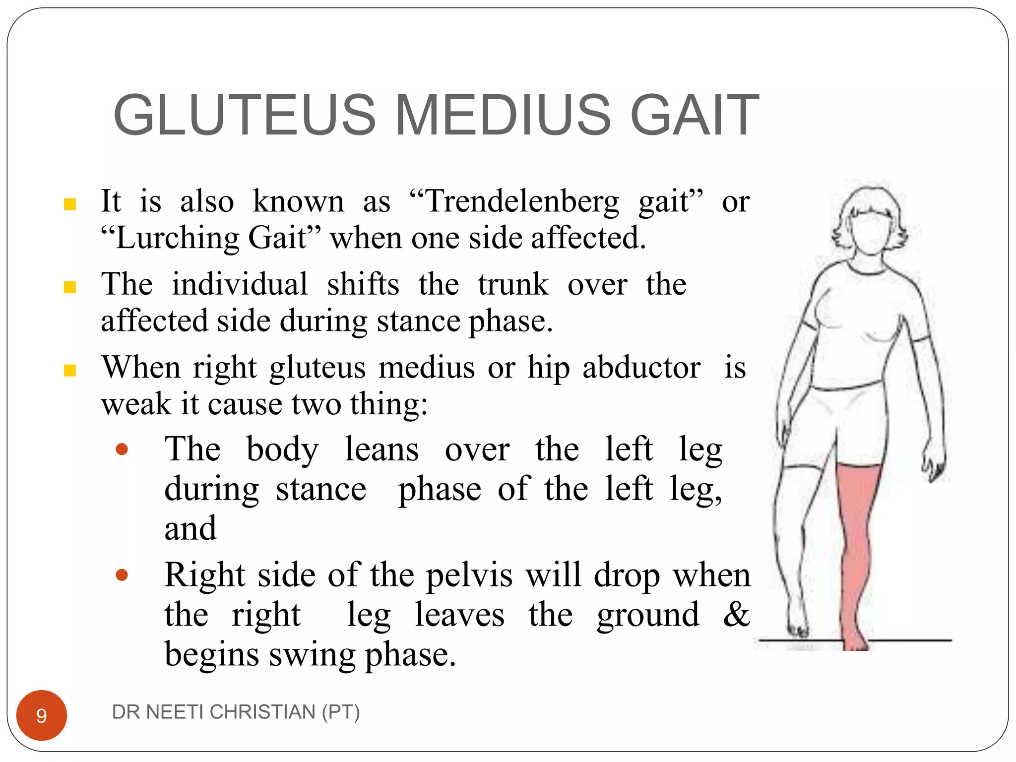 Pathological gait | PPTX