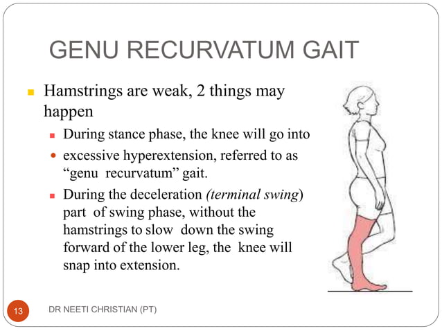 Pathological gait | PPTX