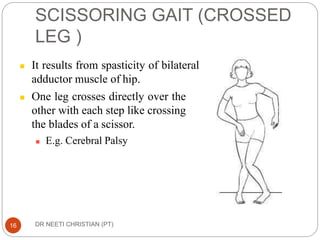 Pathological gait | PPTX