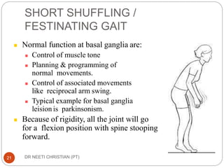 Pathological gait | PPTX