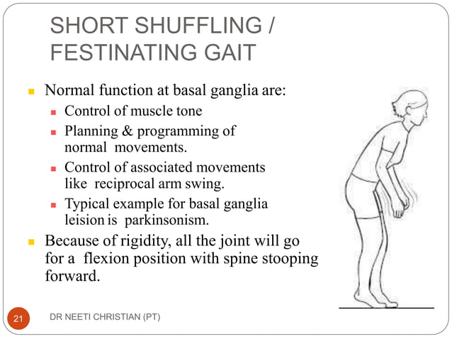 Pathological gait | PPTX