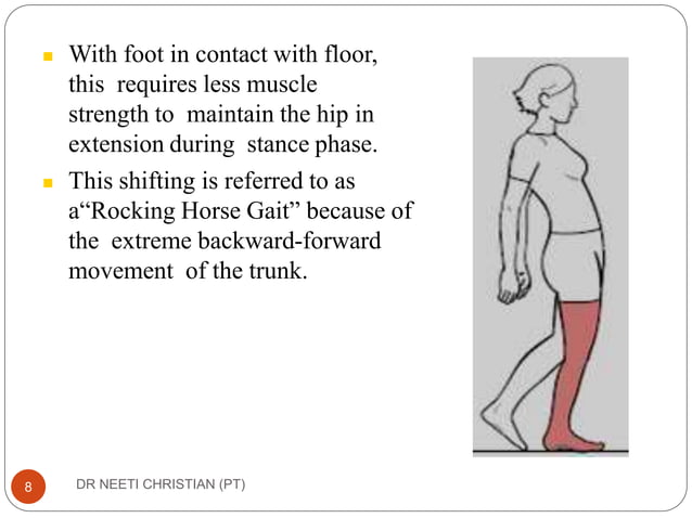 Pathological gait | PPTX