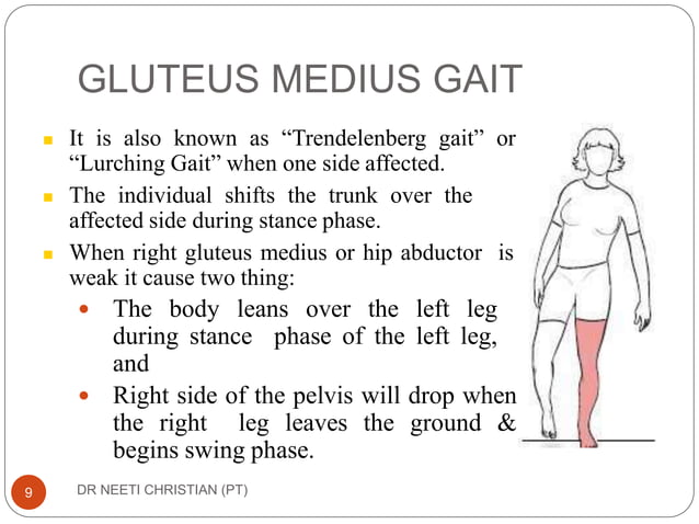 Pathological gait | PPTX