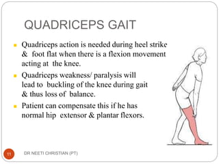 Quadriceps Gait 883a