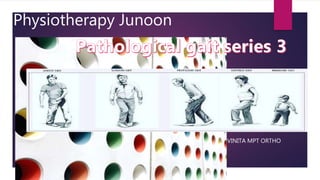 PHYSIOTHERAPY JUNOON Dr.Vinita Pathological gait series 3 | PPT | Free Download