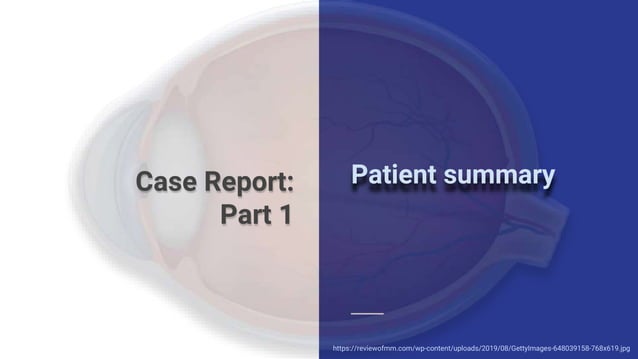 Pathological Myopia and how it can effect CL Rx | PPT