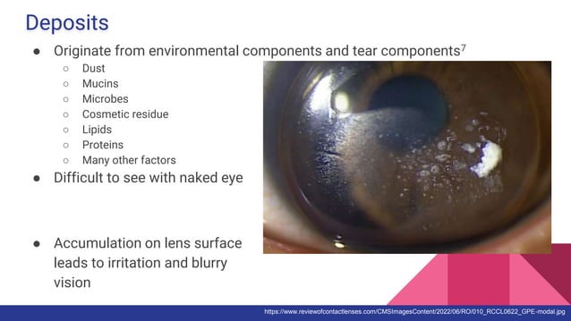 Pathological Myopia and how it can effect CL Rx | PPT