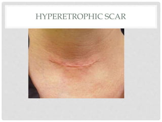 Pathological repair | PPTX