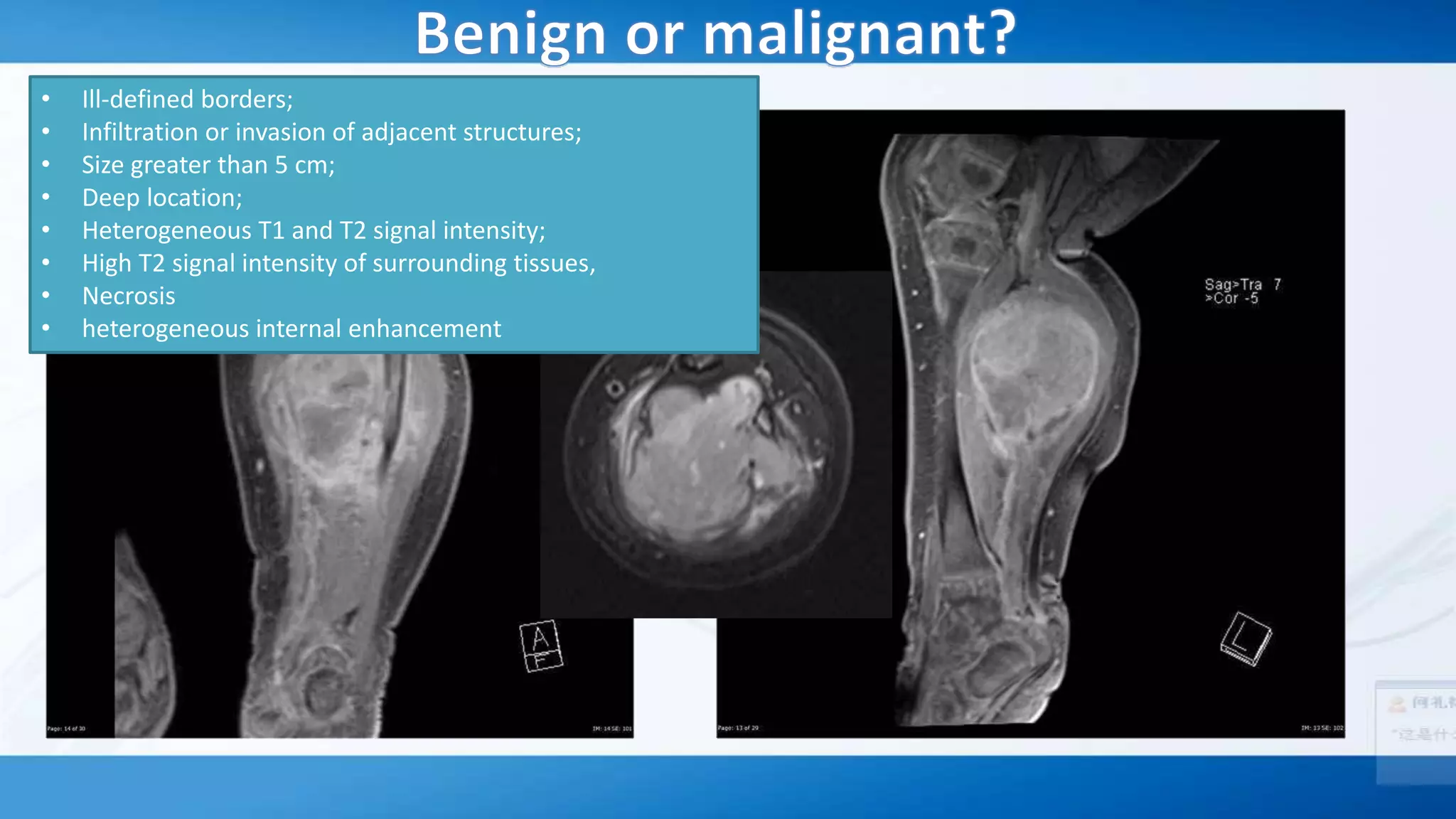 Pathological significance of soft tissue and fat planes | PPTX