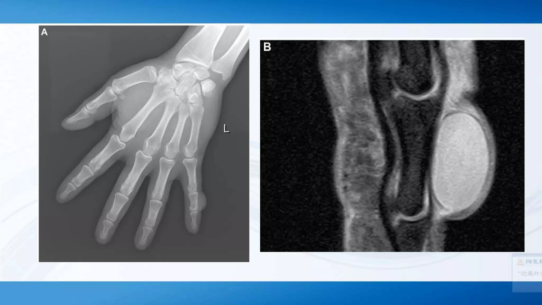 Pathological significance of soft tissue and fat planes | PPTX