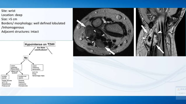 Pathological significance of soft tissue and fat planes | PPTX | Death ...