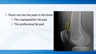 Pathological significance of soft tissue and fat planes | PPTX