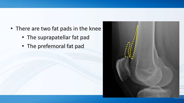 Pathological significance of soft tissue and fat planes | PPTX | Death ...