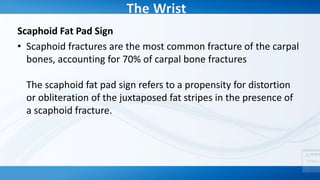 Pathological significance of soft tissue and fat planes | PPTX